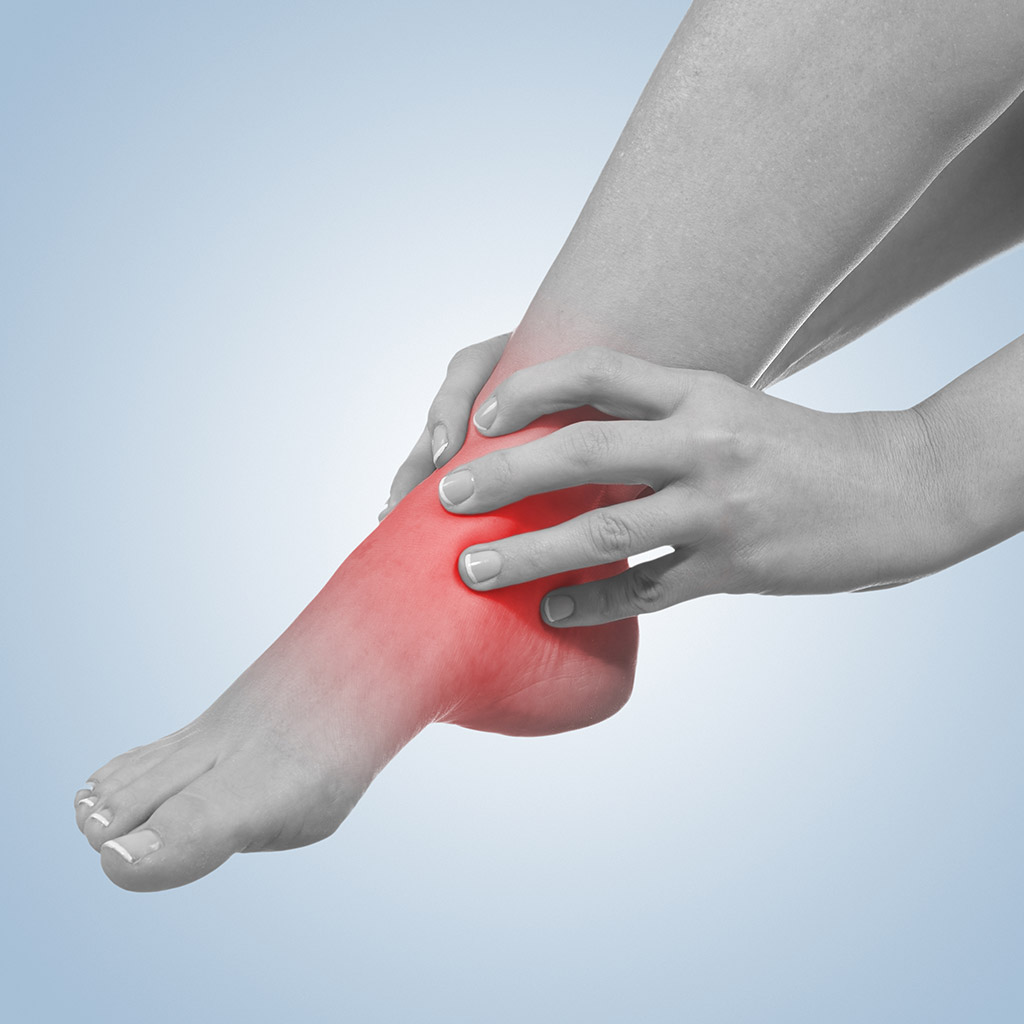 L'arthrose de la cheville - Pied et ChevillePied et Cheville