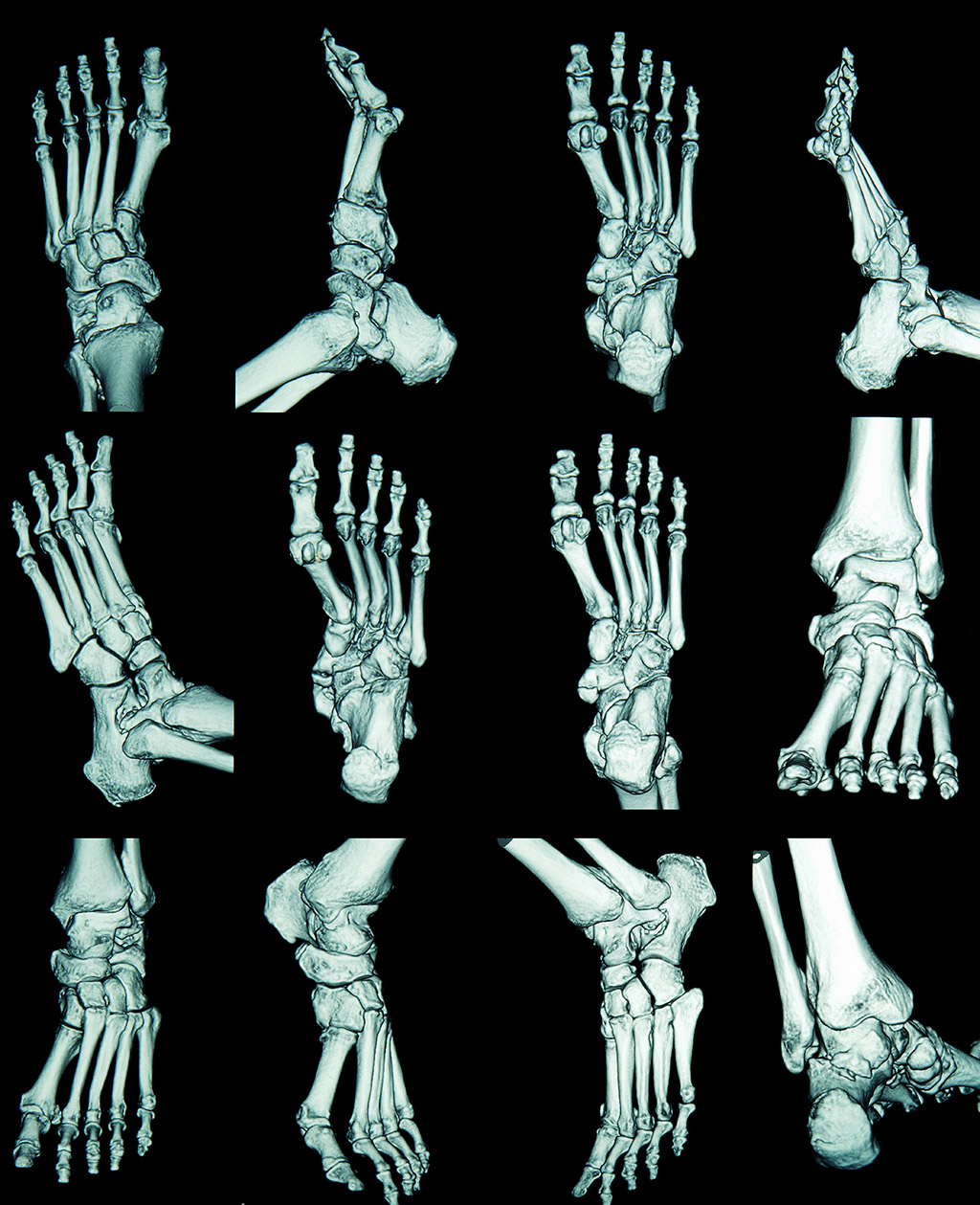 Quel bilan radio? - Pied et ChevillePied et Cheville